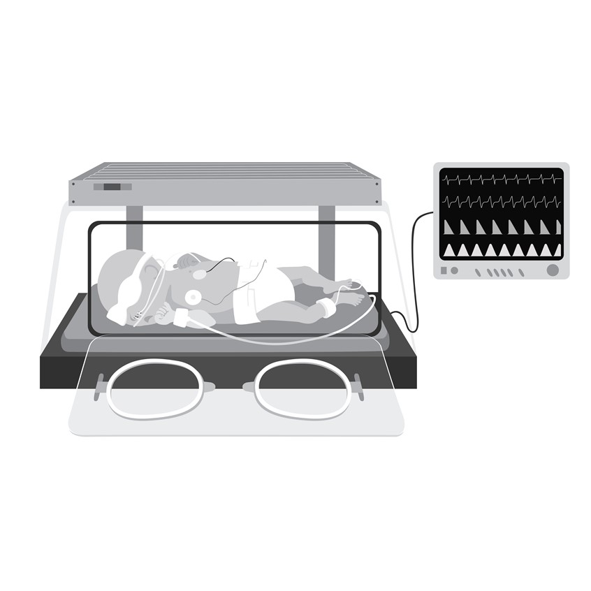 Premature baby in NICU Illustration by Olga Bonitas | Directory of ...